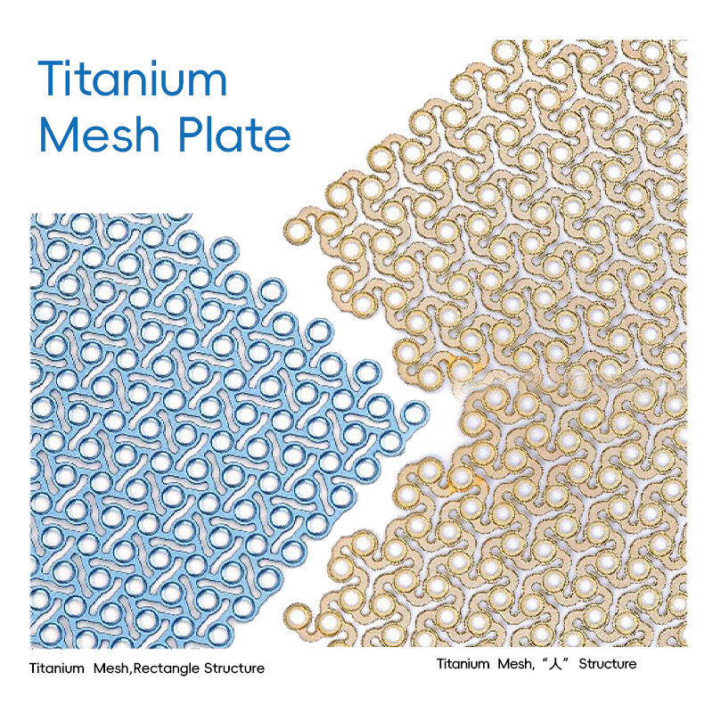Titanium Mesh, "Λ" Structure for Craniofacial Reconstruction | CZMEDITECH